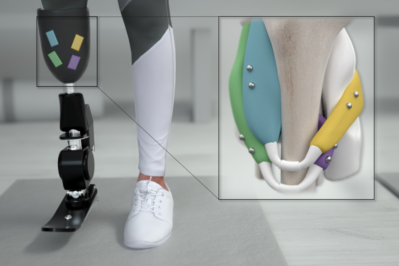 How Prosthetics Improve Quality of Life